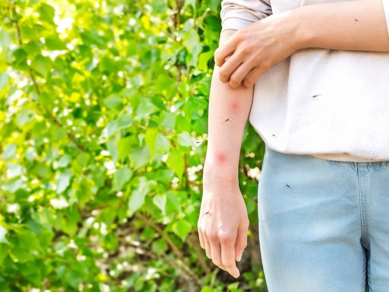 Muggenbeet behandelen? Deze beauty producten helpen!